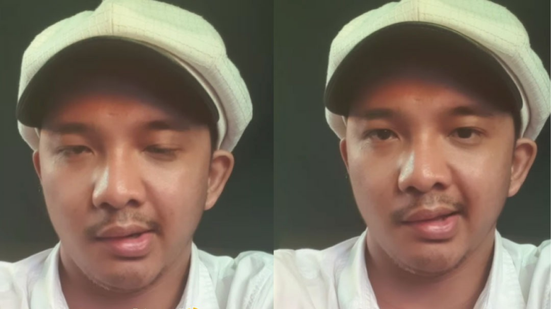 Anak Zarina Zainuddin, Azal menghidap penyakit Bell's Palsy ...